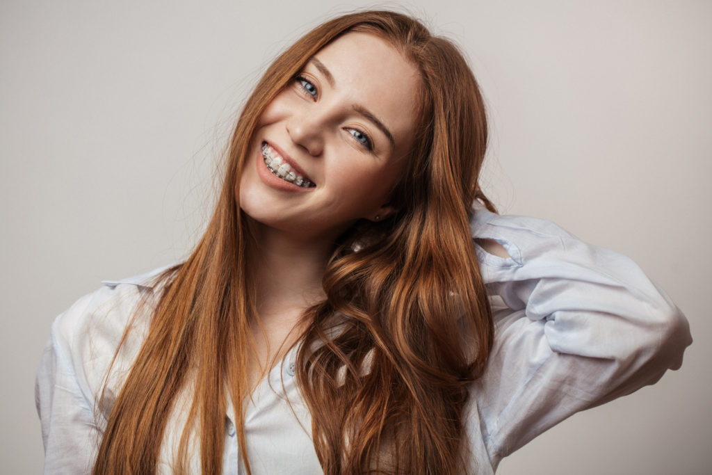 Understanding Different Types of Bracket Bonding - Swan Orthodontics
